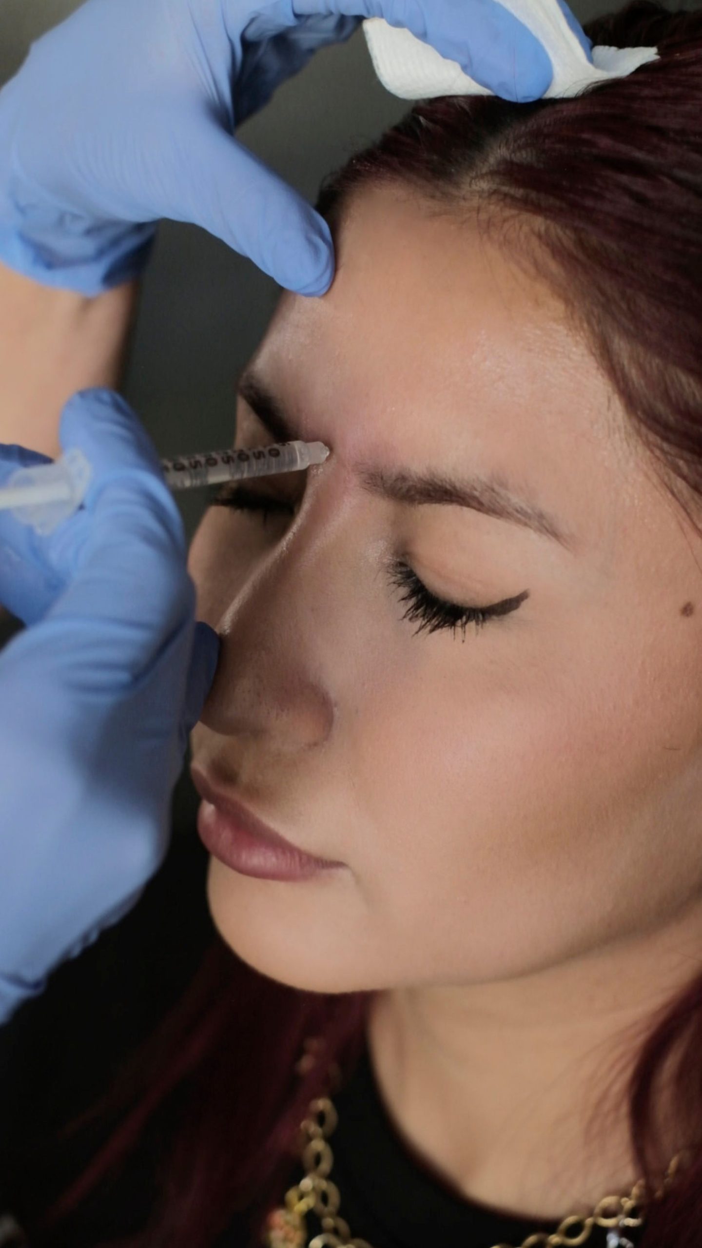 Injectables & Fillers: Skin Care Tucson | Skin Appeal Aesthetics and ...